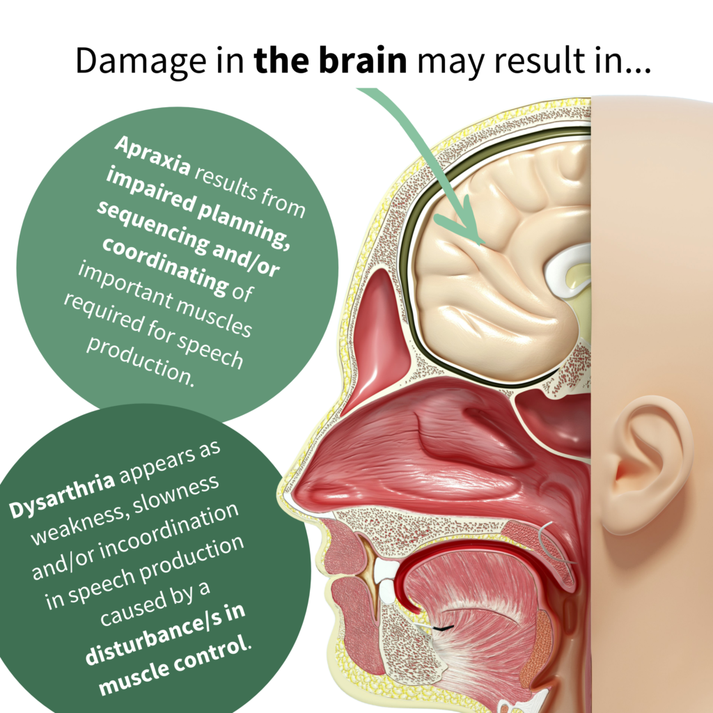 Living with Aphasia (1) - Hills District Speech Therapy